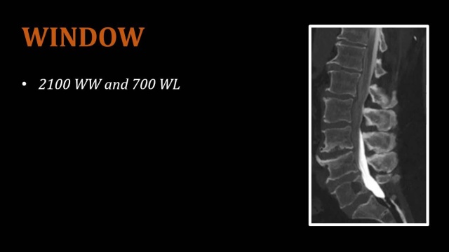 Ct Myelogram Video Lesson Clover Learning
