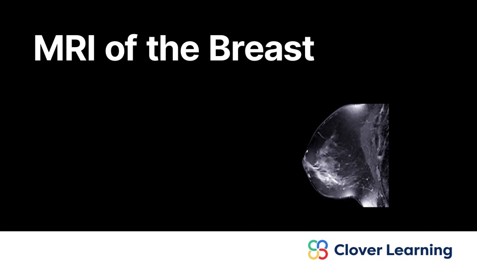 MRI Breast (Anatomy & Pathology) | Video Lesson | Clover Learning