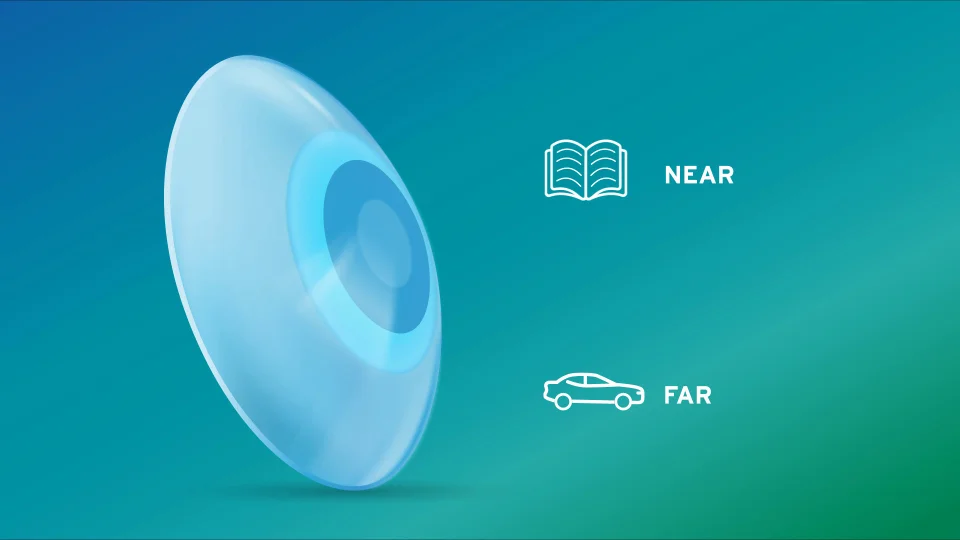 Let’s Talk: Multifocal Contacts