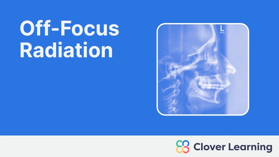 Off-Focus Radiation | Video Lesson | Clover Learning