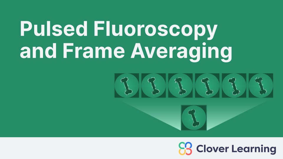 Pulsed Fluoroscopy and Frame Averaging | Video Lesson | Clover Learning