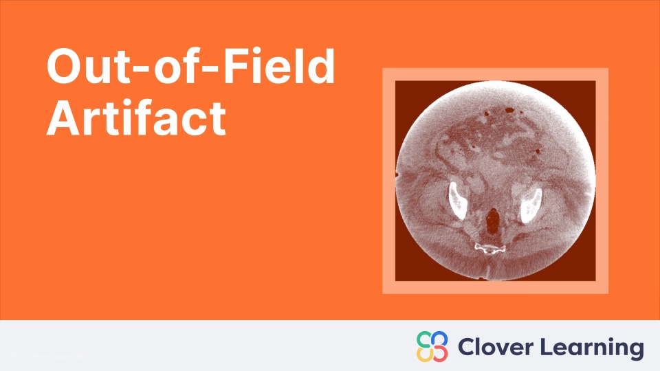 Out-of-Field Artifact | Video Lesson | Clover Learning