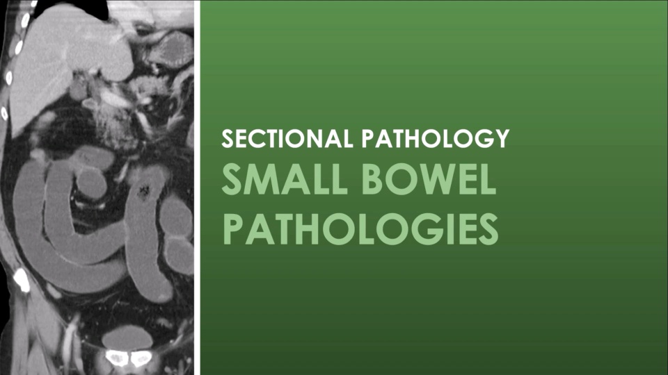 CT Small Bowel Pathologies | Video Lesson | Clover Learning