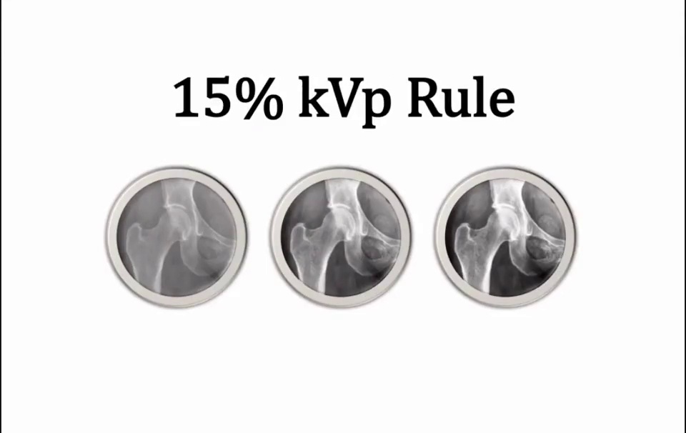 15% Rule Equation & Practice | Video Lesson | Clover Learning