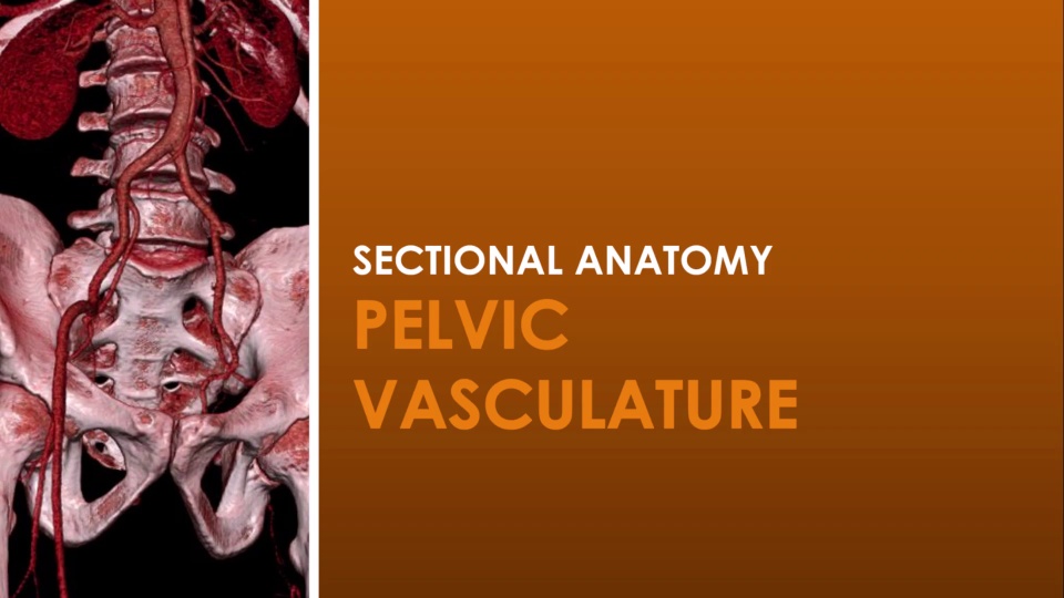 CT Pelvic Vasculature | Video Lesson | Clover Learning