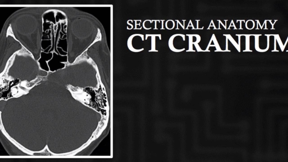 CT Cranium (Axial) | Video Lesson | Clover Learning