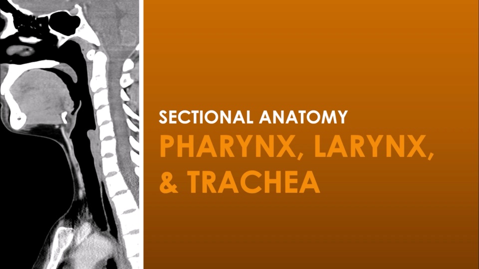 CT Pharynx, Larynx, & Trachea | Video Lesson | Clover Learning