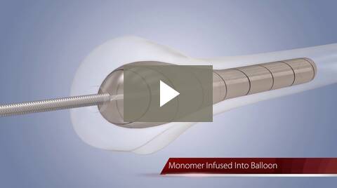 Surgical Videos | illuminoss