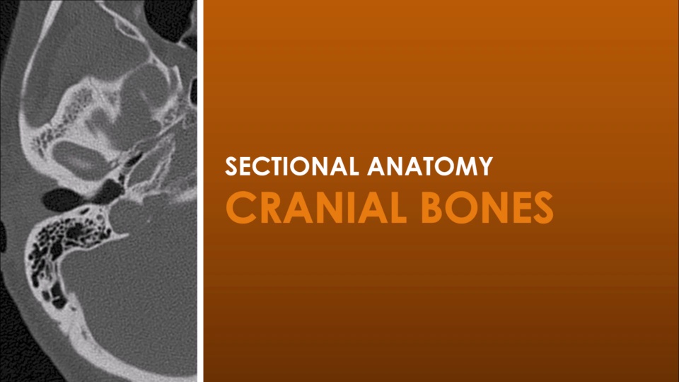 CT Cranial Bones | Video Lesson | Clover Learning