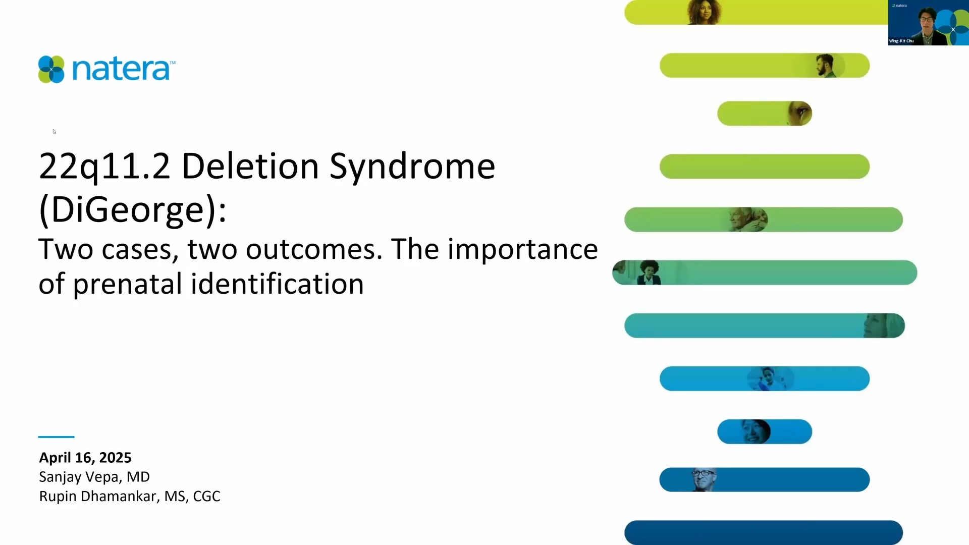 22q11.2 Deletion Syndrome (DiGeorge): Two cases, two outcomes. The importance of prenatal identifica