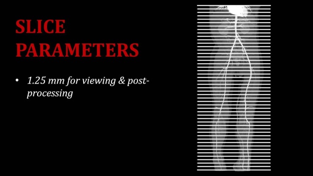 CTA Run-Off | Video Lesson | Clover Learning