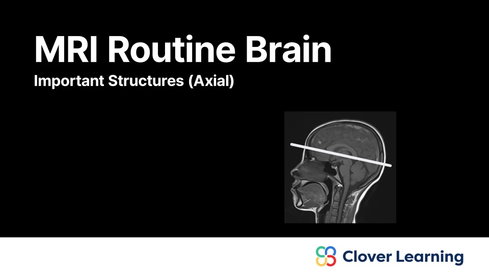 MRI Routine Brain - Important Structures (Axial) | Video Lesson ...