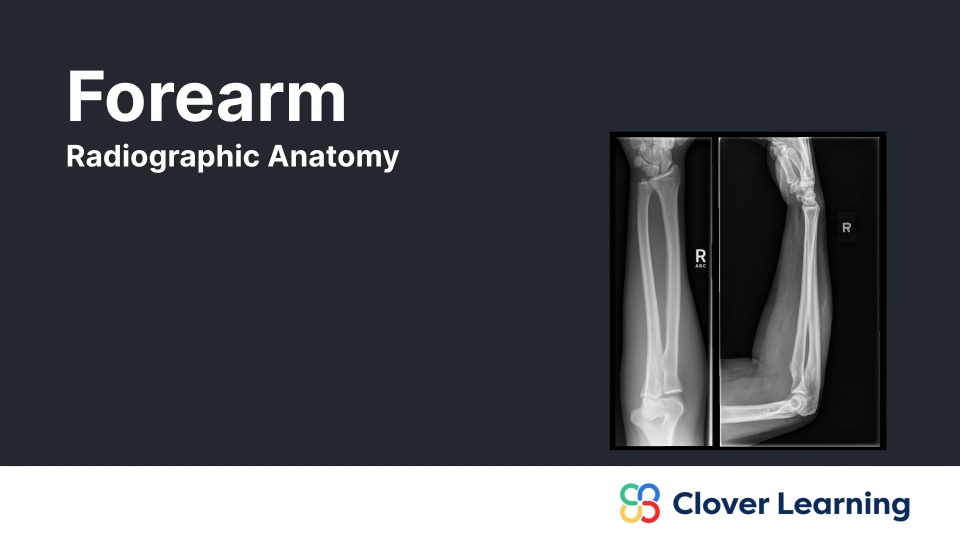 Forearm: Radiographic Anatomy | Video Lesson | Clover Learning