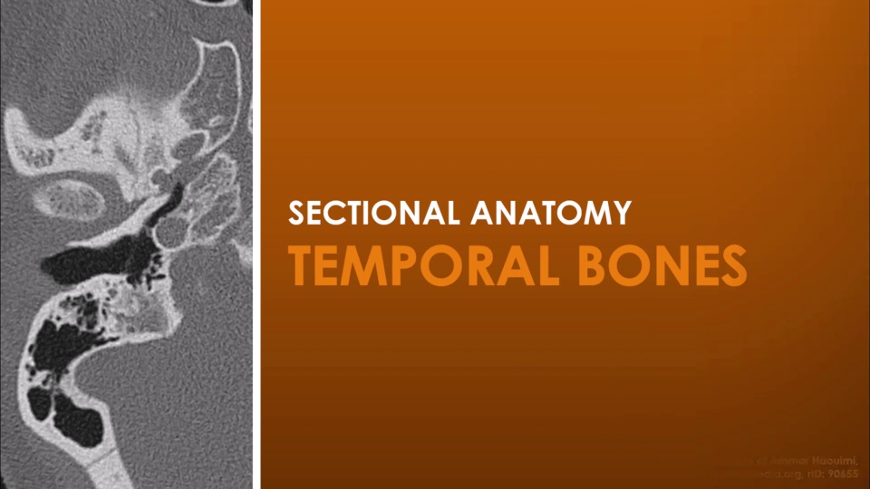 CT Temporal Bones (Anatomy) | Video Lesson | Clover Learning