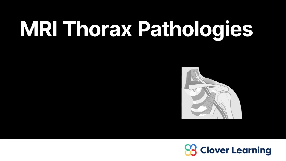 MRI Thorax (Pathology) | Video Lesson | Clover Learning