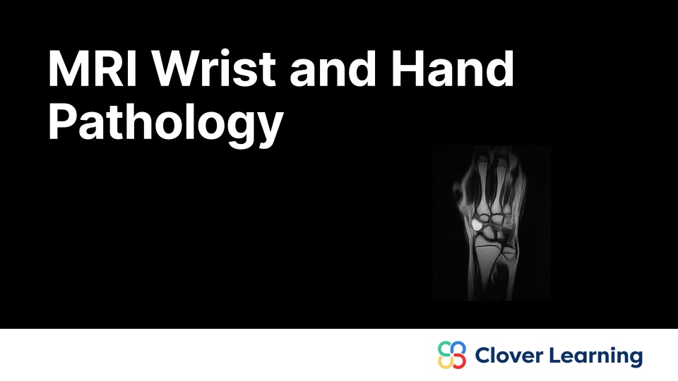 MRI Hand/Wrist (Pathology) | Video Lesson | Clover Learning