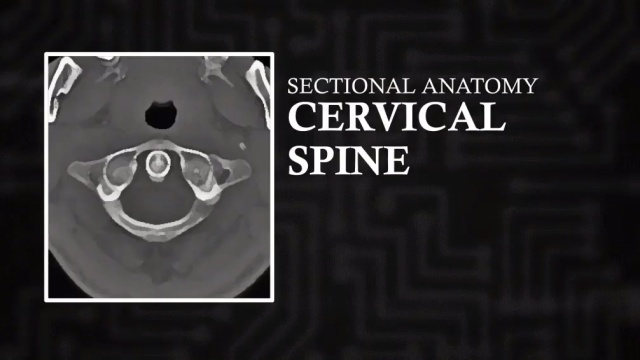 CT Cervical (Axial) | Video Lesson | Clover Learning