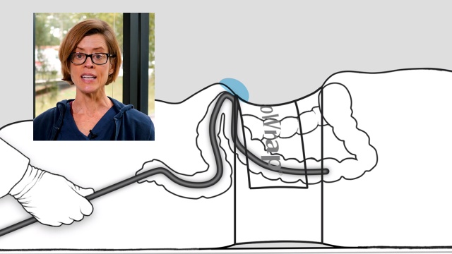 Getting the most out of ColoWrap