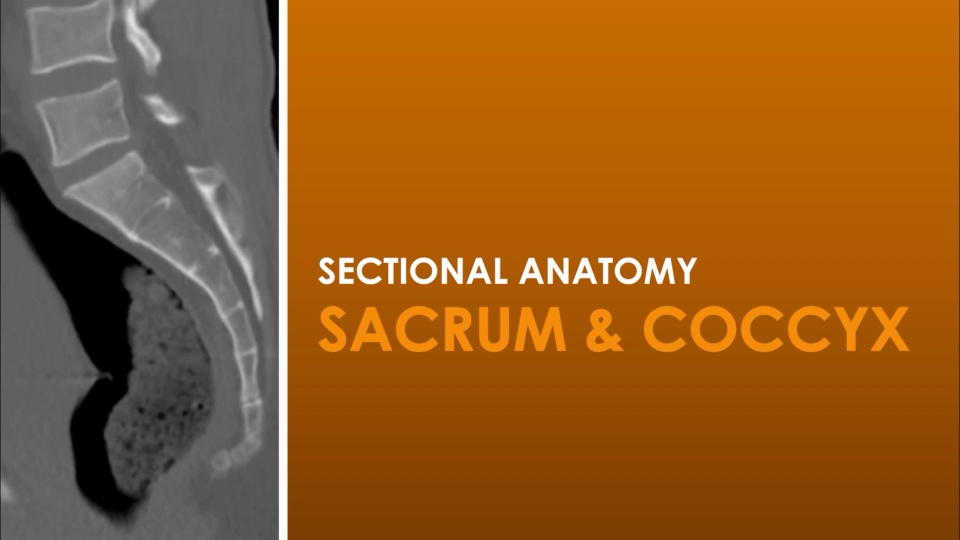 CT Sacrum & Coccyx | Video Lesson | Clover Learning