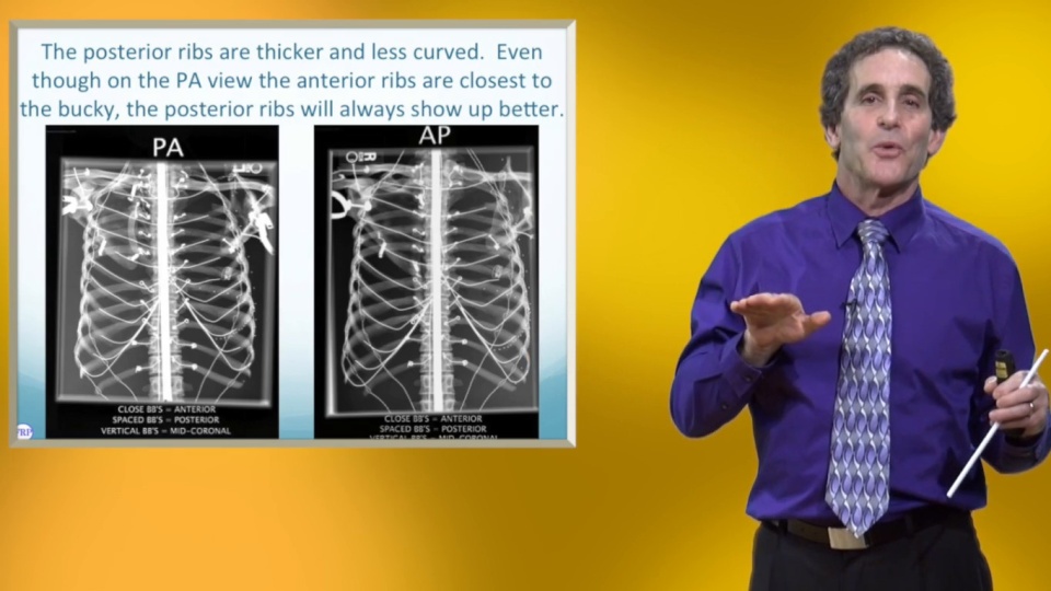 PA Anterior Ribs | Video Lesson | Clover Learning