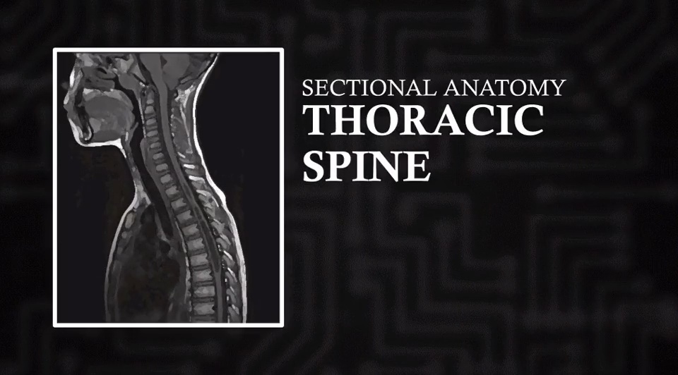 MRI Thoracic (Sagittal) | Video Lesson | Clover Learning
