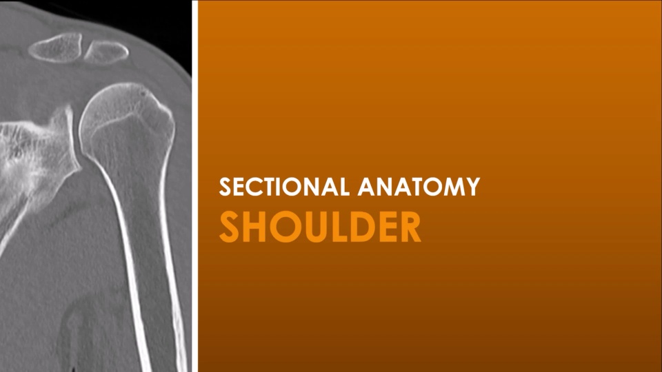 CT Shoulder | Video Lesson | Clover Learning