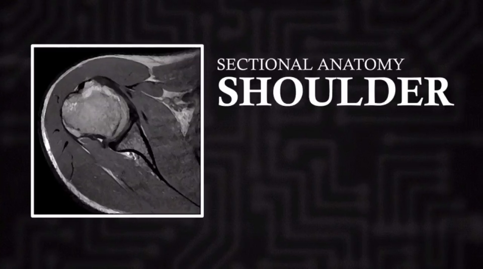 MRI Shoulder (Axial) | Video Lesson | Clover Learning