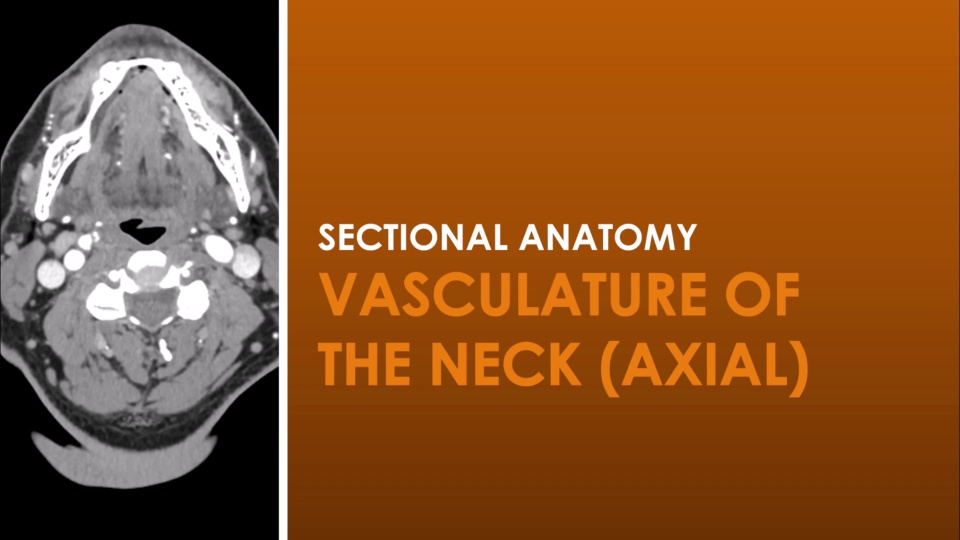 CT Anatomy Neck Vasculature (Axial) | Video Lesson | Clover Learning