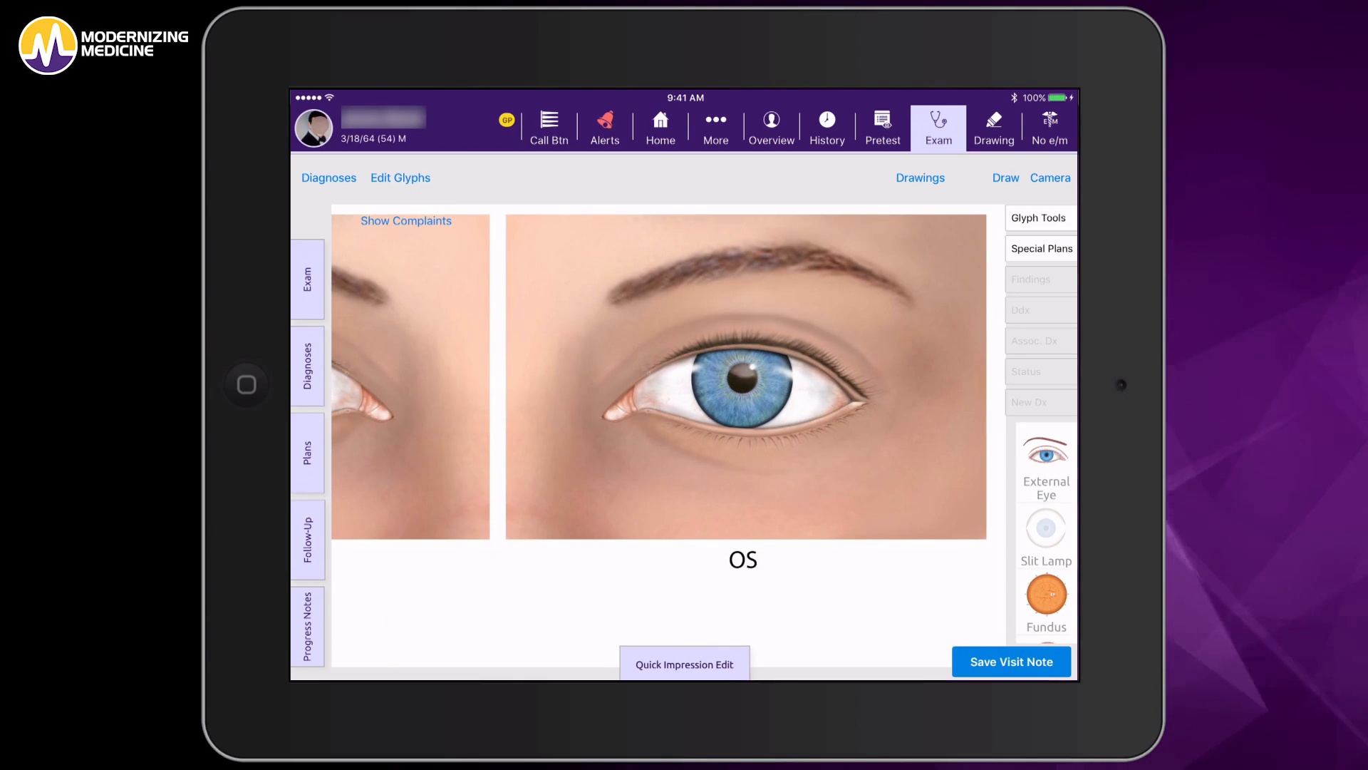 Documenting an Eye Exam in Our Ophthalmology EHR, EMA™