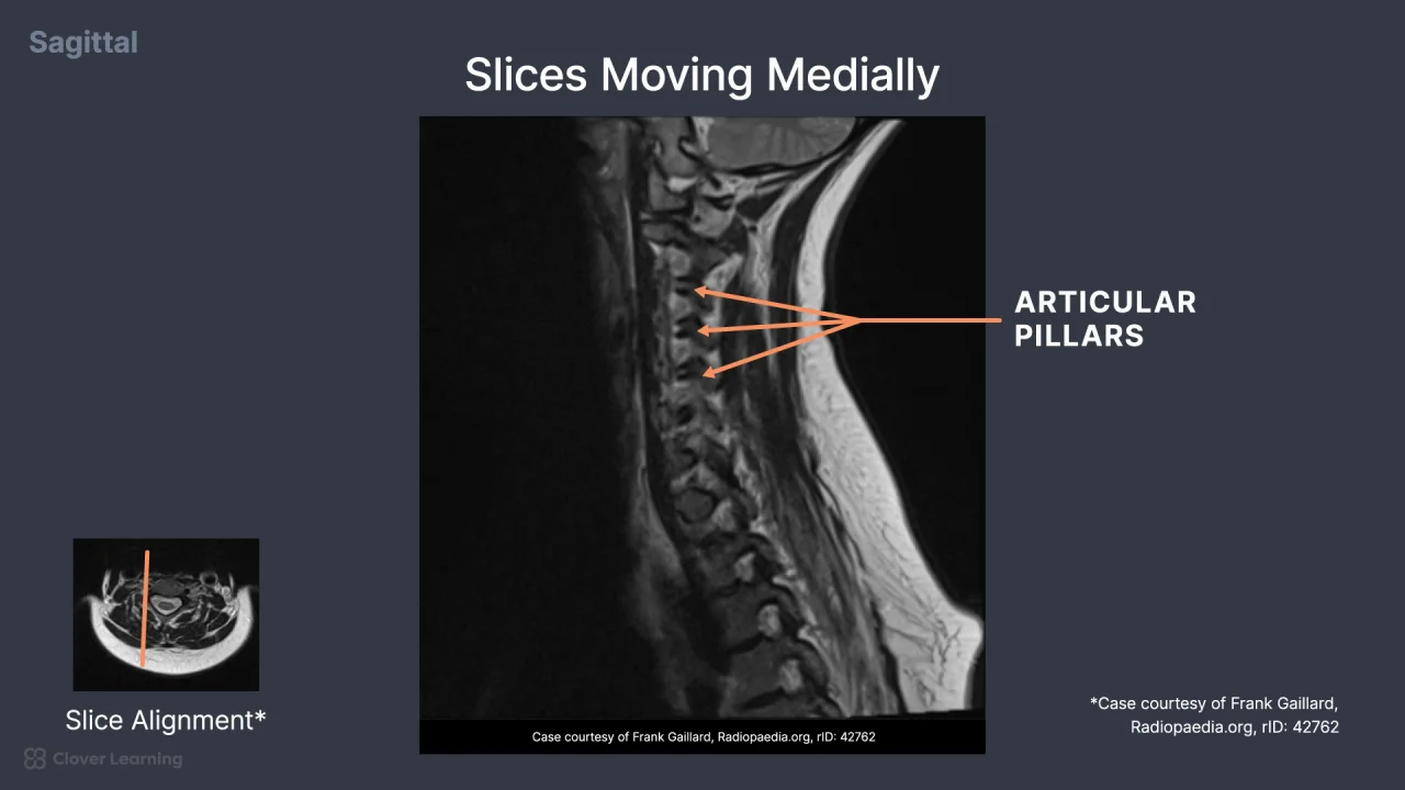 Cervical Spine Mri Labeled MRI Spine Anatomy | Free MRI Lumbar Spine