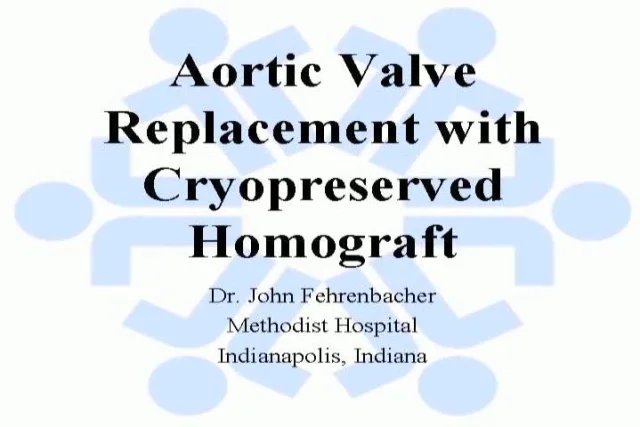 Aortic Replacement with Cryopreserved Homograft - CryoLife, Inc.