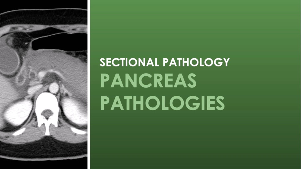 CT Pancreas Pathologies | Video Lesson | Clover Learning