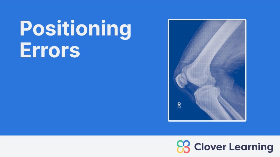 Positioning Errors Video Lesson Clover Learning