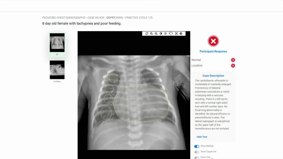 Pediatric Chest Radiographs