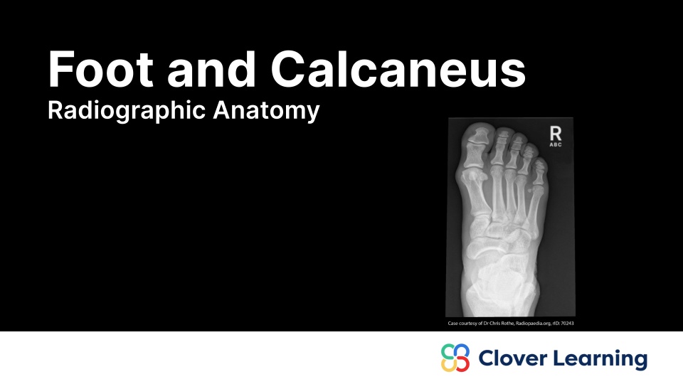 Foot & Calcaneus: Radiographic Anatomy | Video Lesson | Clover Learning