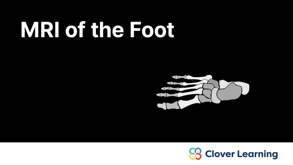 MRI Foot (Anatomy) | Video Lesson | Clover Learning