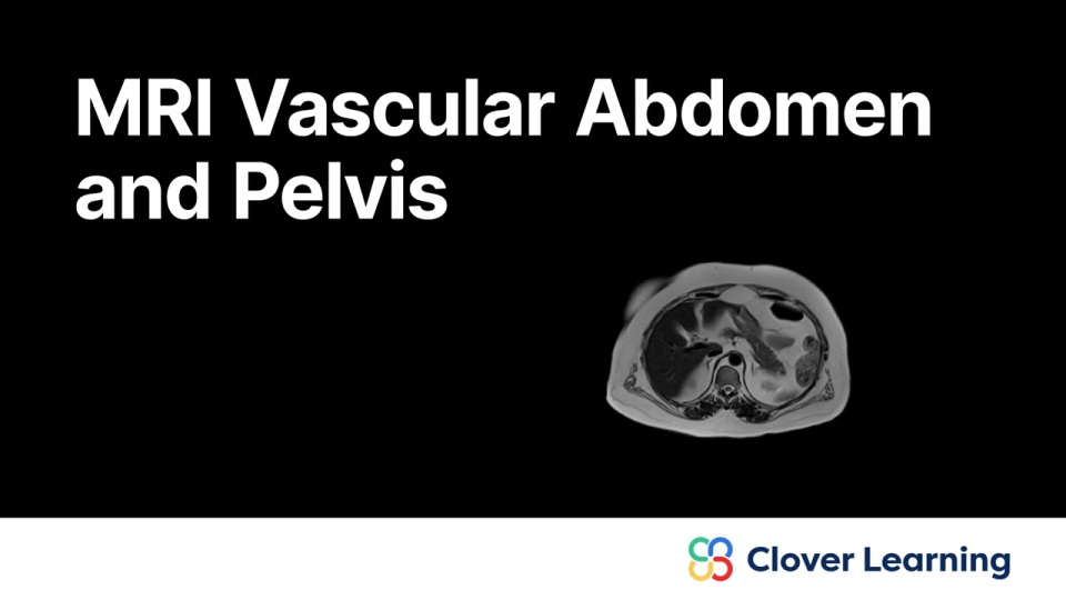 MRI Vascular Abdomen and Pelvis (Anatomy) | Video Lesson | Clover Learning