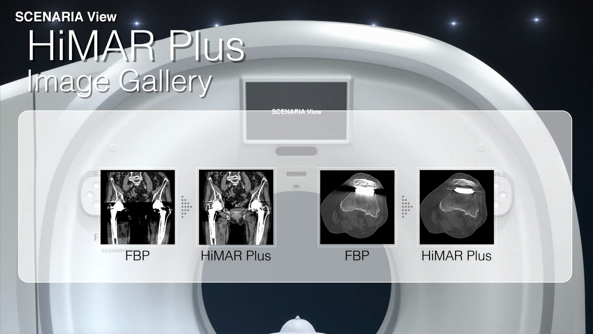 CT Scanners | Trinity Imaging Solutions