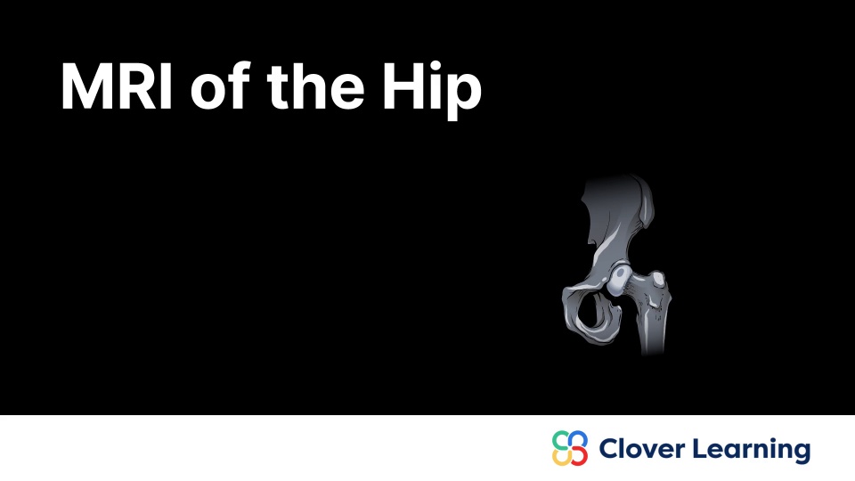 MRI Hip (Anatomy & Pathology) | Video Lesson | Clover Learning