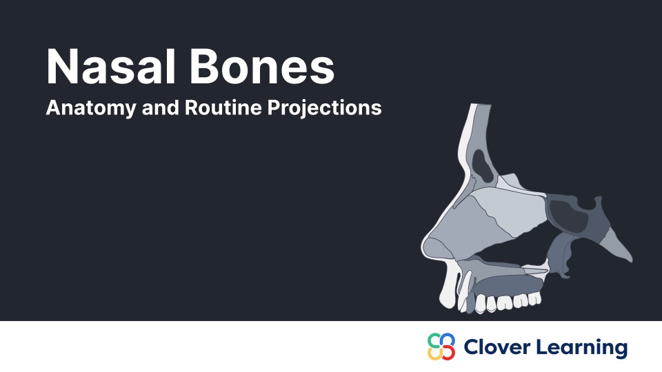 Nasal Bones: Anatomy & Routine Projections | Video Lesson | Clover Learning