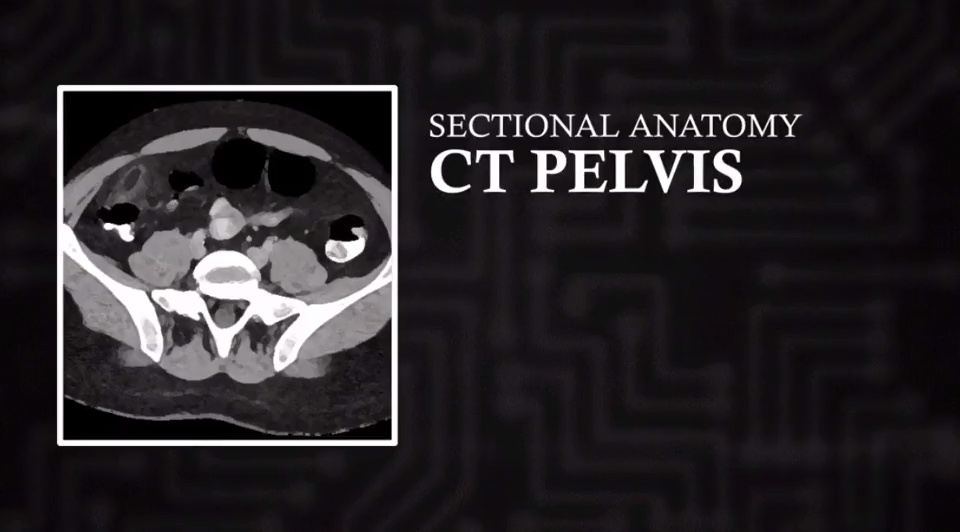 CT Pelvis (Axial) | Video Lesson | Clover Learning