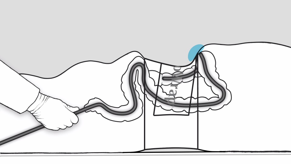 Physician Video Guide