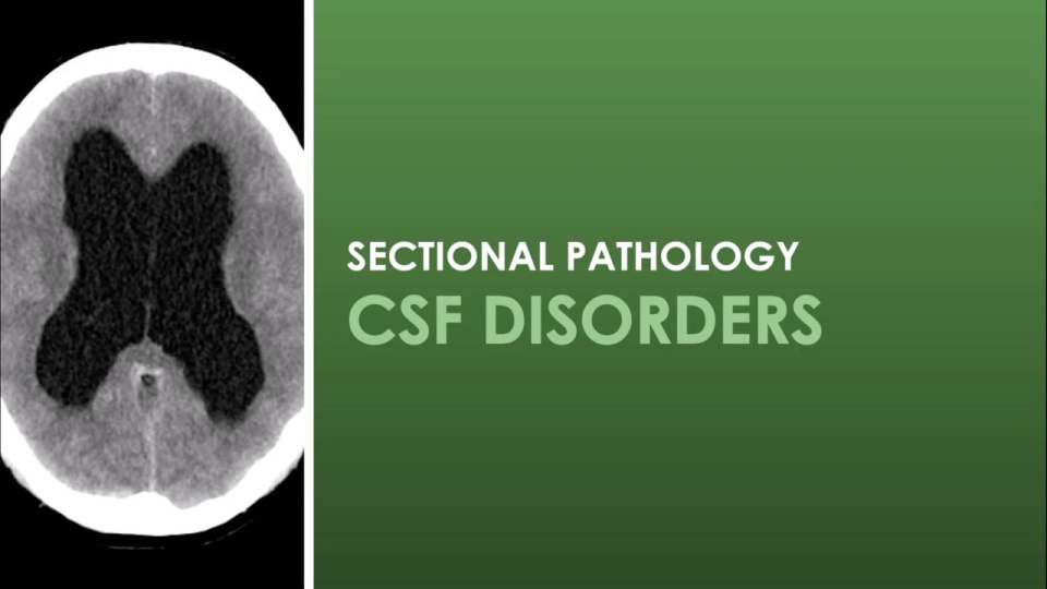 CT Brain CSF Disorders | Video Lesson | Clover Learning
