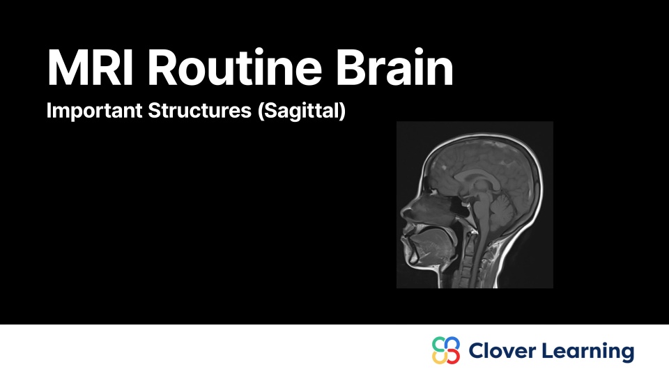 MRI Routine Brain - Important Structures (Sagittal) | Video Lesson ...