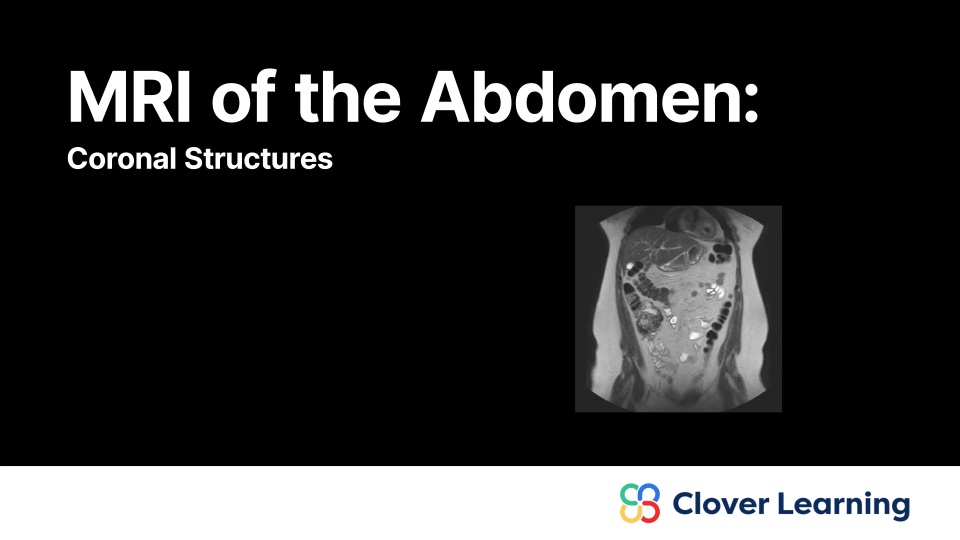 MRI Abdomen Anatomy: Important Structures (Coronal) | Video Lesson ...