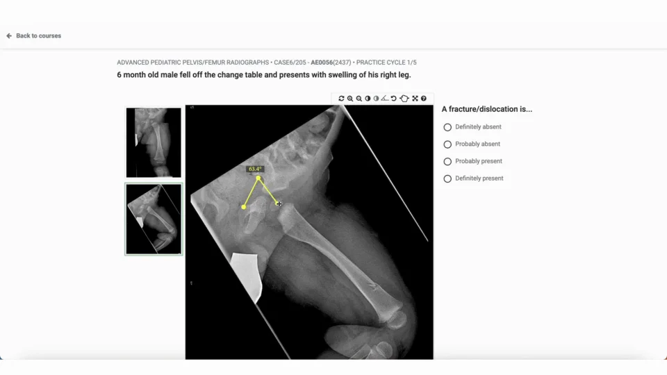 Advanced Pediatric Musculoskeletal Radiographs - Diagnosis and Management