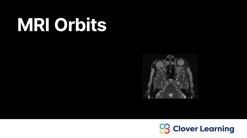MRI Orbits (Anatomy) | Video Lesson | Clover Learning