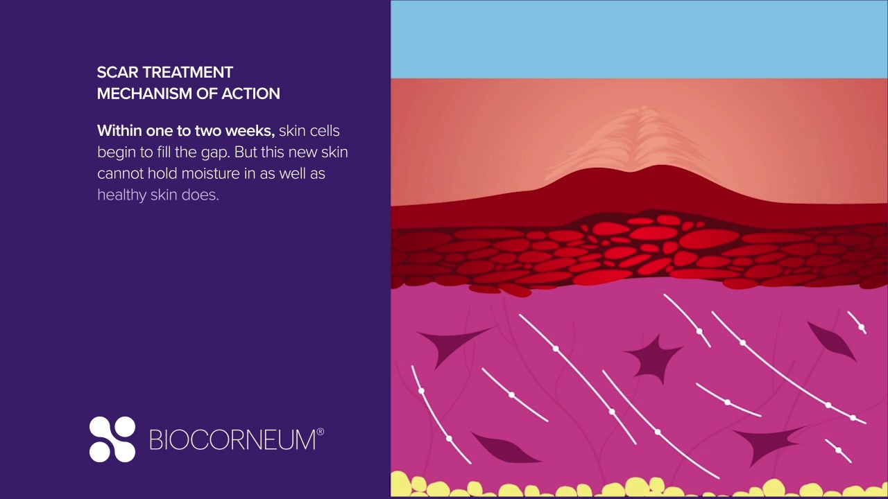 Biocorneum – MedResults Network