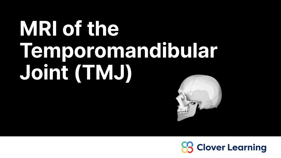 MRI TMJs (Anatomy) | Video Lesson | Clover Learning