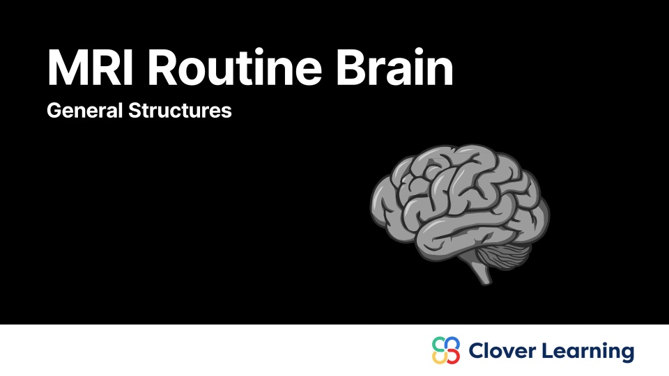 MRI Routine Brain: General Structures (Anatomy) | Video Lesson | Clover ...